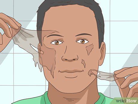 3 Ways To Treat Melasma WikiHow
