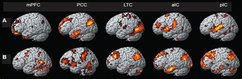 Resting State Connectivity In The Default Mode Network And I
