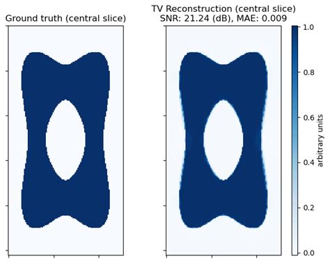 3D TV Regularized Sparse View CT Reconstruction Proximal ADMM Solver