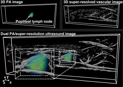 Researchers Develop Low Cost Dual Modality Imaging Technique Axis