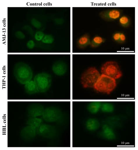 Apoptotic Markers In Amj 13 Thp 1 And Hbl Cells Treated With Agnps At