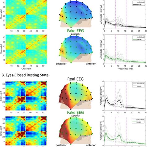 Examples Of Eye Open A And Eyes Closed B Resting State EEG For Download Scientific Diagram