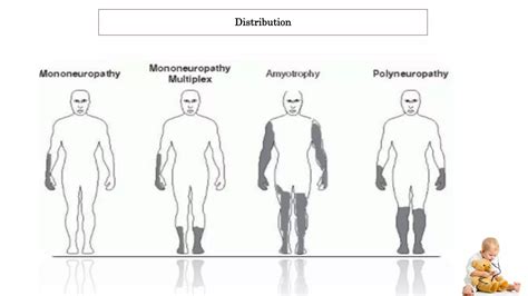 Giant Axonal Neuropathy Ppt