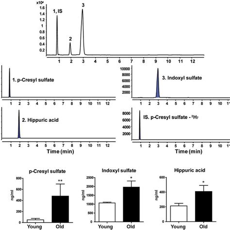 Quantification Of Uremic Toxin Metabolites In Plasma Using Uplc Tq Ms