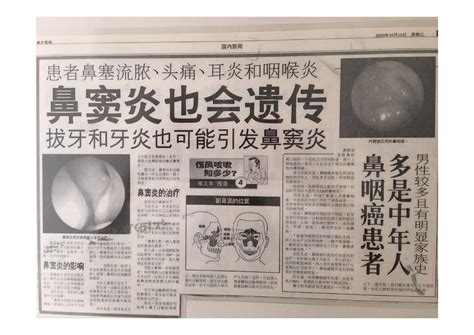 Sinusitis Can Be Inherited Or Caused By Dental Problems