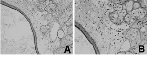 Photomicrographs Showing Stratified Squamous Epithelium Sebaceous