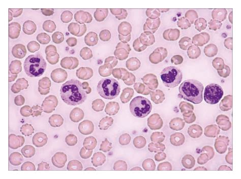 Clumped Leukocytes And The Segmentation Result A Clumped Leukocytes