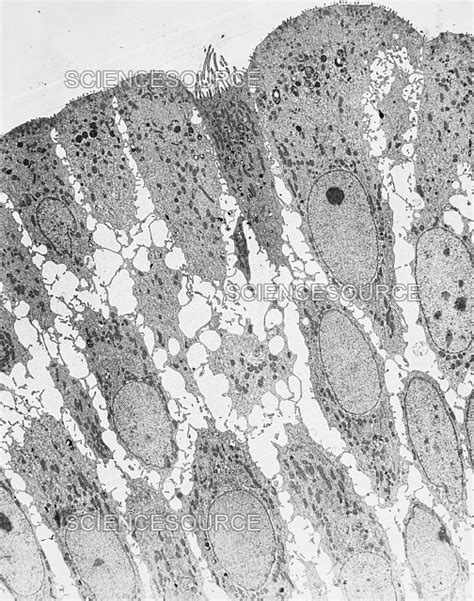 Epithelial Cells Tem Stock Image Science Source Images