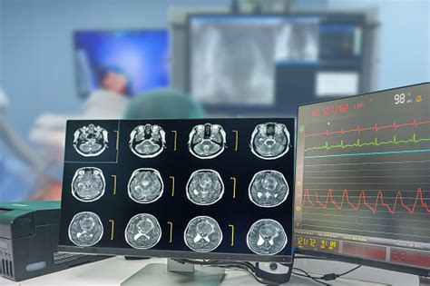Ct Scan Otak Menemukan Massa Isodense Dengan Margin Yang Tidak Jelas