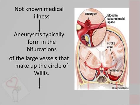 Ppt Title “subarachnoid Haemorrhage” Powerpoint Presentation Free