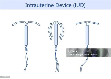 Intrauterine Device Or Iud Intrauterine Contraceptive Device Vector