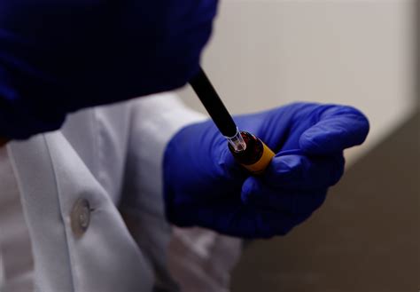 Sample Testing Peanut Ppm Sample Testing Peanut Ppm