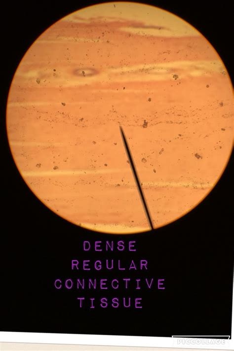 Dense Regular Connective Tissue Histology Slides Anatomy And