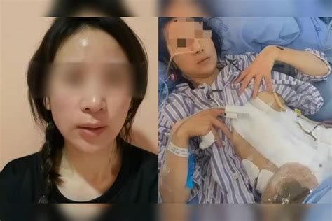 2年被家暴16次需终身挂粪袋受害人：不要民事赔偿，希望判他死刑