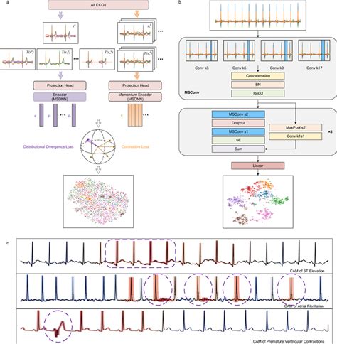 Neural Network Architectures And Visualization Of Models Attention A