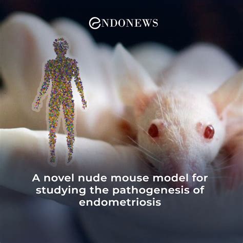 Researchers Develop New Mouse Model Of Endometriosis Endonews