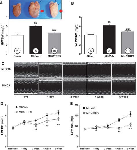 C1qtumor Necrosis Factorrelated Protein 9 A Novel Adipocyte Derived