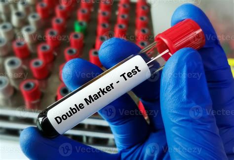 How Does Double Marker Test Work At Liza Finley Blog