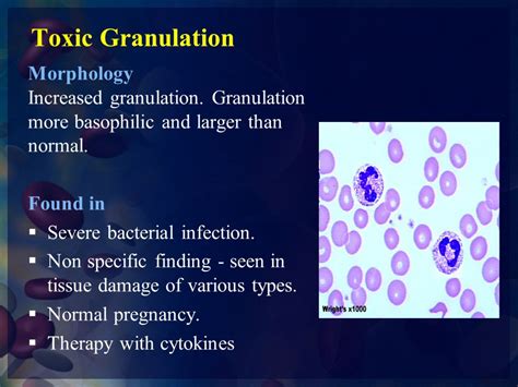 Toxic Granulation Vs Basophil