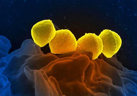 New Strain Of Strep Linked To Rise In Infections Microbiology