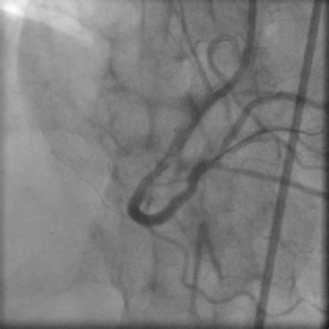 Morphological Closing Operation On An Xa Image A The Original Image