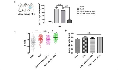 Genetic Inhibition Of Nexilin Impedes Oligodendrocyte Progenitor Cell