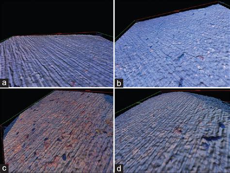 Influence Of Light And Laser Activation Of Tooth Bleaching Systems On Enamel Microhardness And