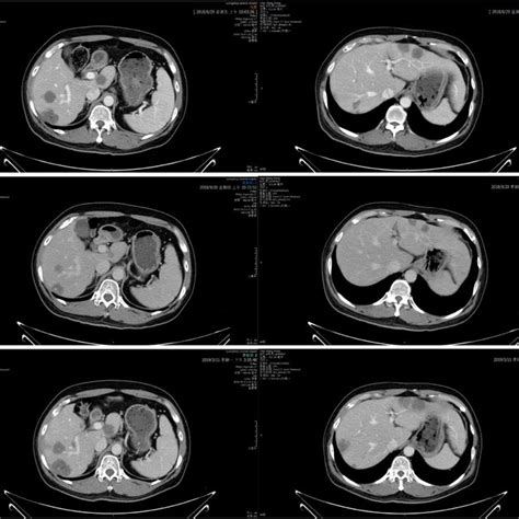 Serial Circulating Tumor Dna Testing For Monitoring Lapatinib Download Scientific Diagram