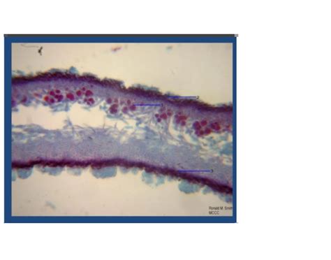 Label The Lichen Quiz