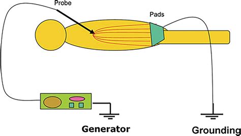 Radiofrequency Microneedling Clinical Tree