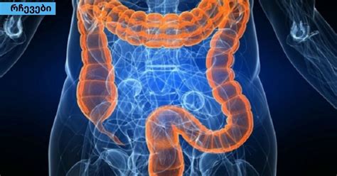 როგორ გავიწმინდოთ ნაწლავები სახლის პირობებში ყველაზე ეფექტური მეთოდი