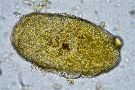 Premium Photo Agronomist With A Soil Sample With Soil Life And Bugs