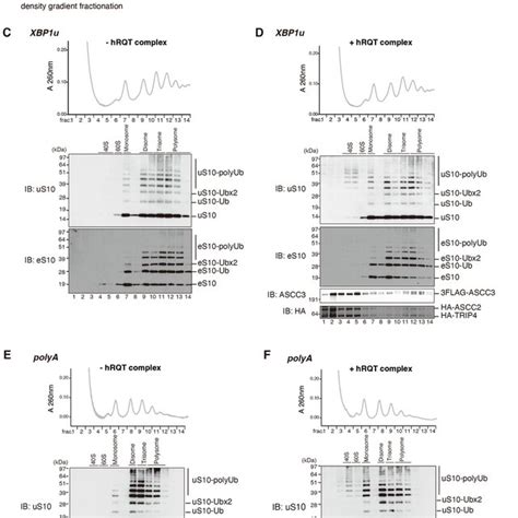 Cryo EM Structure Comparison Of The Human XBP1 Stalled Disome And The
