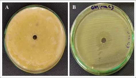 A Skim Milk Agar Showing Hydrolysis All Over The Plate B 25 Mm