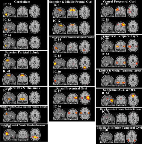 Group Ics Results The Extracted 23 Components Were Grouped Into 14