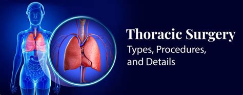 Thoracic Surgery Types Procedures And Details Rela Hospital
