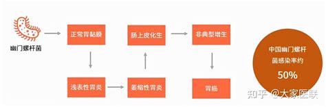 幽门螺旋杆菌怎么查？ 知乎