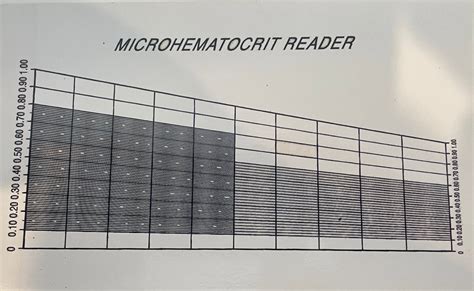 75mm Micro Hematocrit Reader Vet1 Pty Ltd