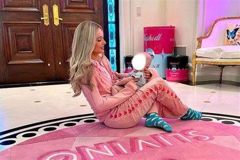 Qué Es Macrocefalia E Hidrocefalia Enfermedades Del Bebé De Paris Hilton