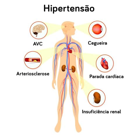 Sal em excesso é prejudicial à saúde Tua Saúde