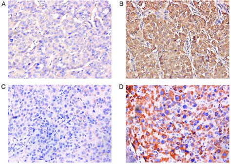 Expression Levels Of Il 6 And Il 6r As Detected By Download