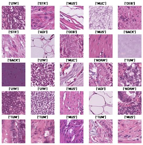 Dataset Examples Of The Different Tissues With Random Augmentation