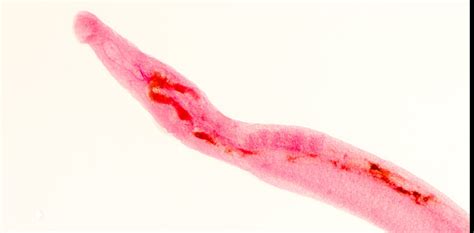Tracking Vampire Worms With Machine Learning Using Ai To Diagnose