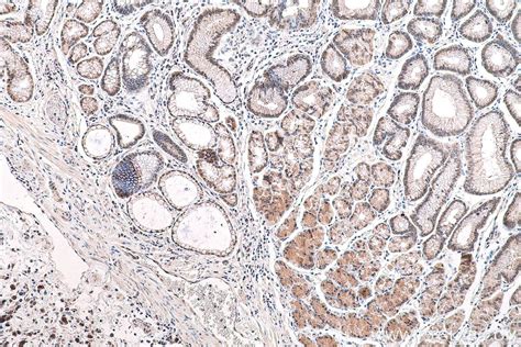 ihceasy ruvbl1 ready to use ihc kit khc0828 proteintech