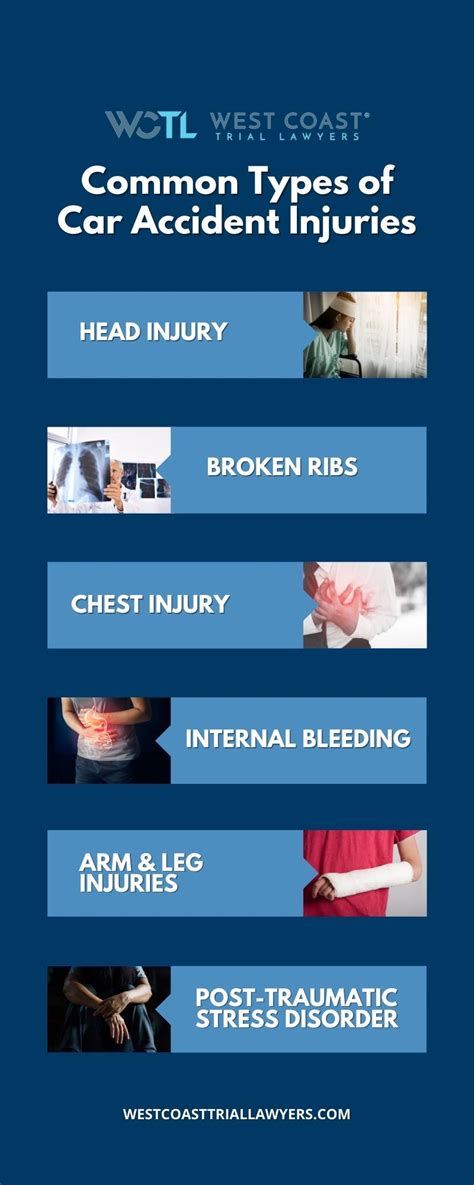 17 Most Common Car Accident Injuries With Examples