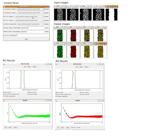 Confined Displacement Algorithm Determines True And Random Colocalization Imagej Documentation Confined Displacement Algorithm Determines True And Random Colocalization Imagej Documentation