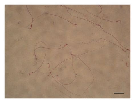 Diff Quick Staining Of Sperm Cells A Sperm Cells Isolated From Download Scientific Diagram