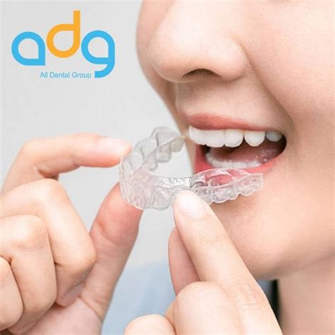 Do You Have To Wear A Retainer Forever After Invisalign • All Dental Group