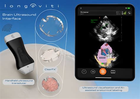 Longeviti Launches Clearfit Ai™ A Brain Ultrasound Interface Bui To