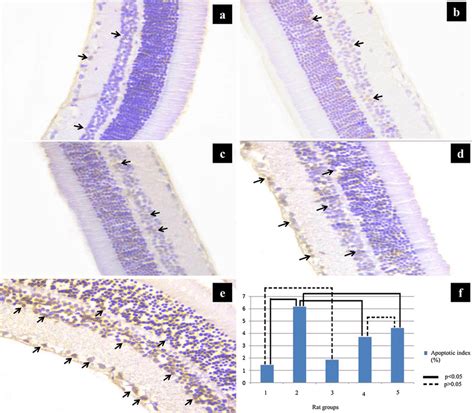 A Light Microscopic Examination Of Tunel Staining For Apoptotic Cells